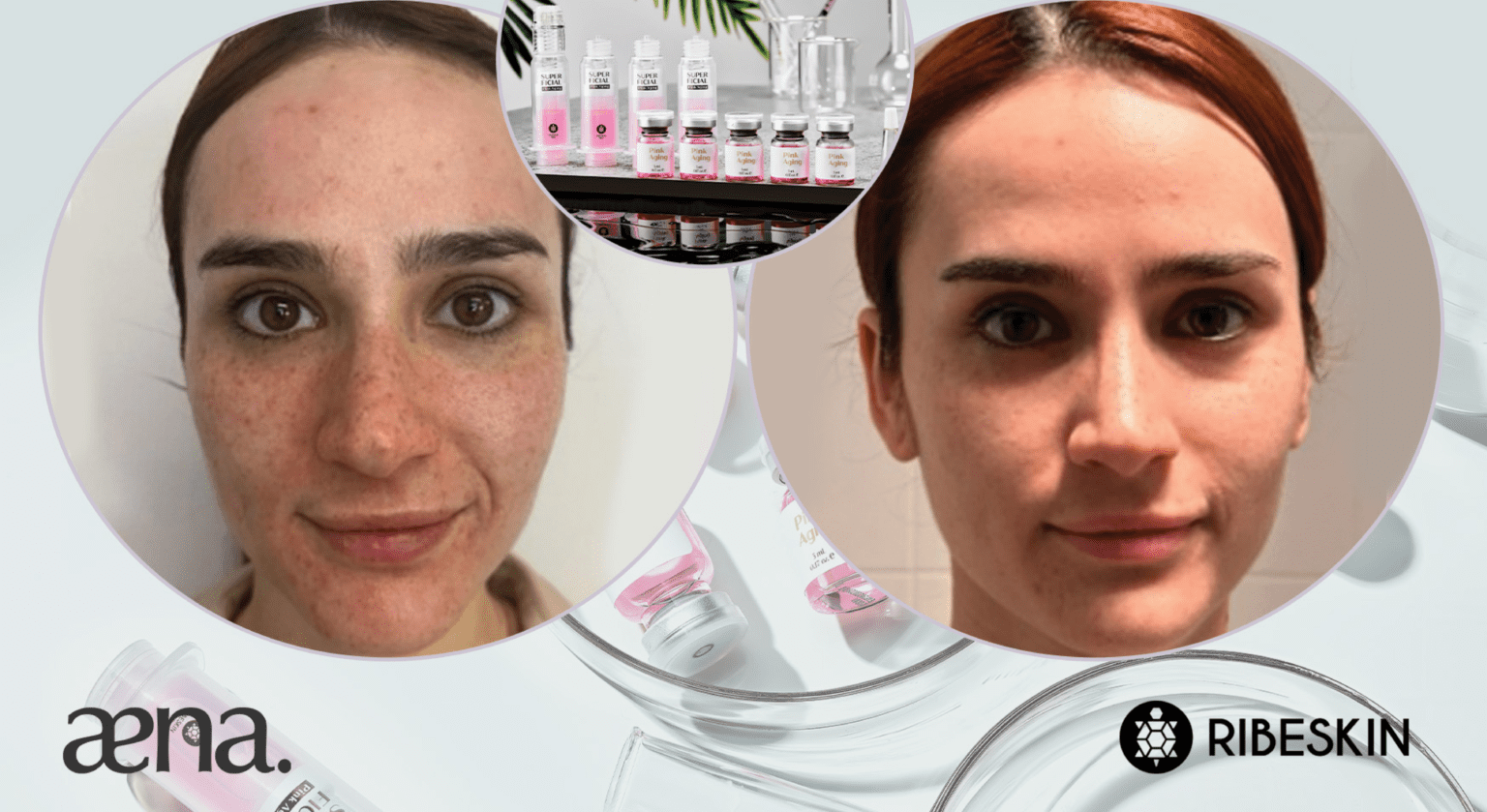 Θεραπεία Pink Aging Shooter - MedSpa Center